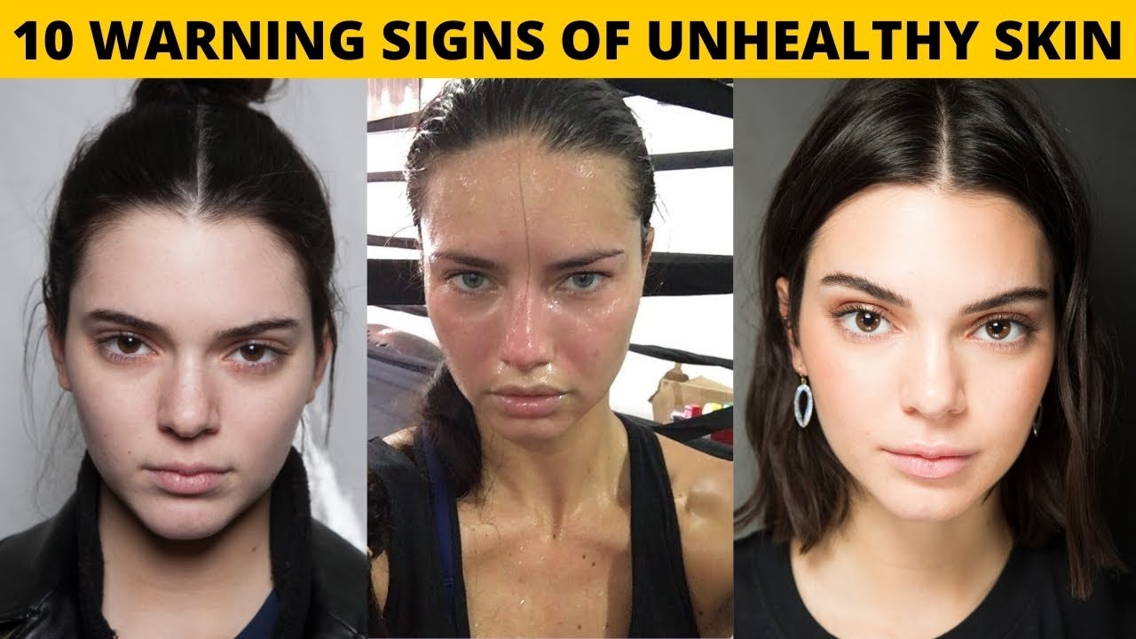 A Sign Your Face Sends When You Are Not Healthy! - Kafigonka